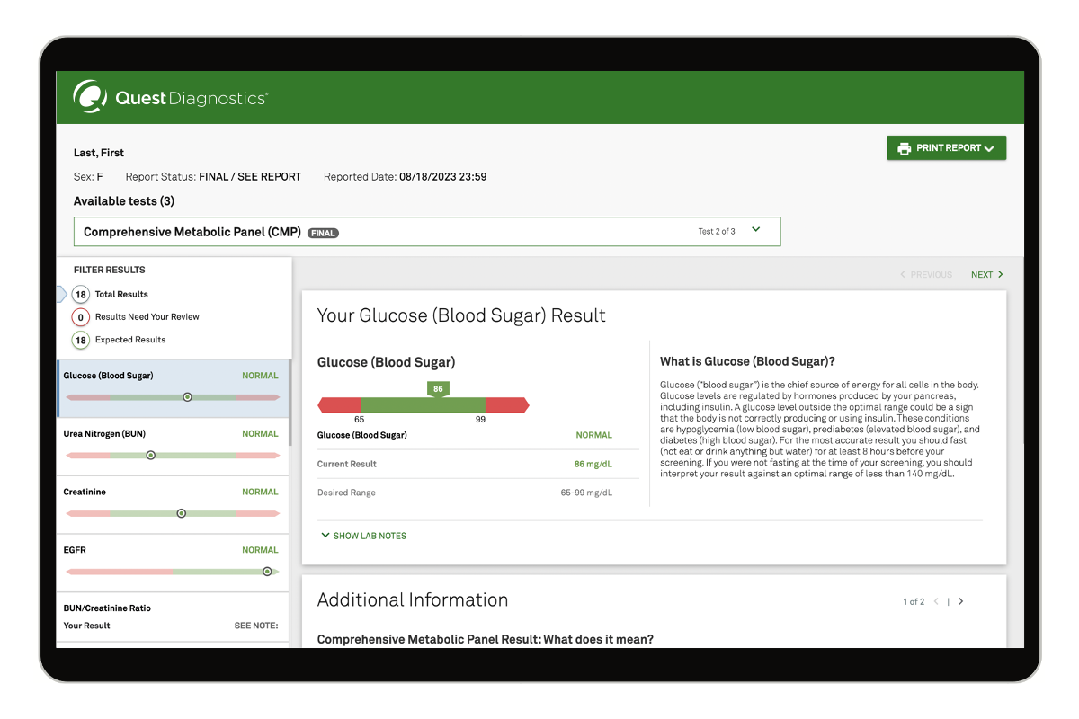Find Reliable CMP Tools in the Quest Test Directory – Guide to Quest ...